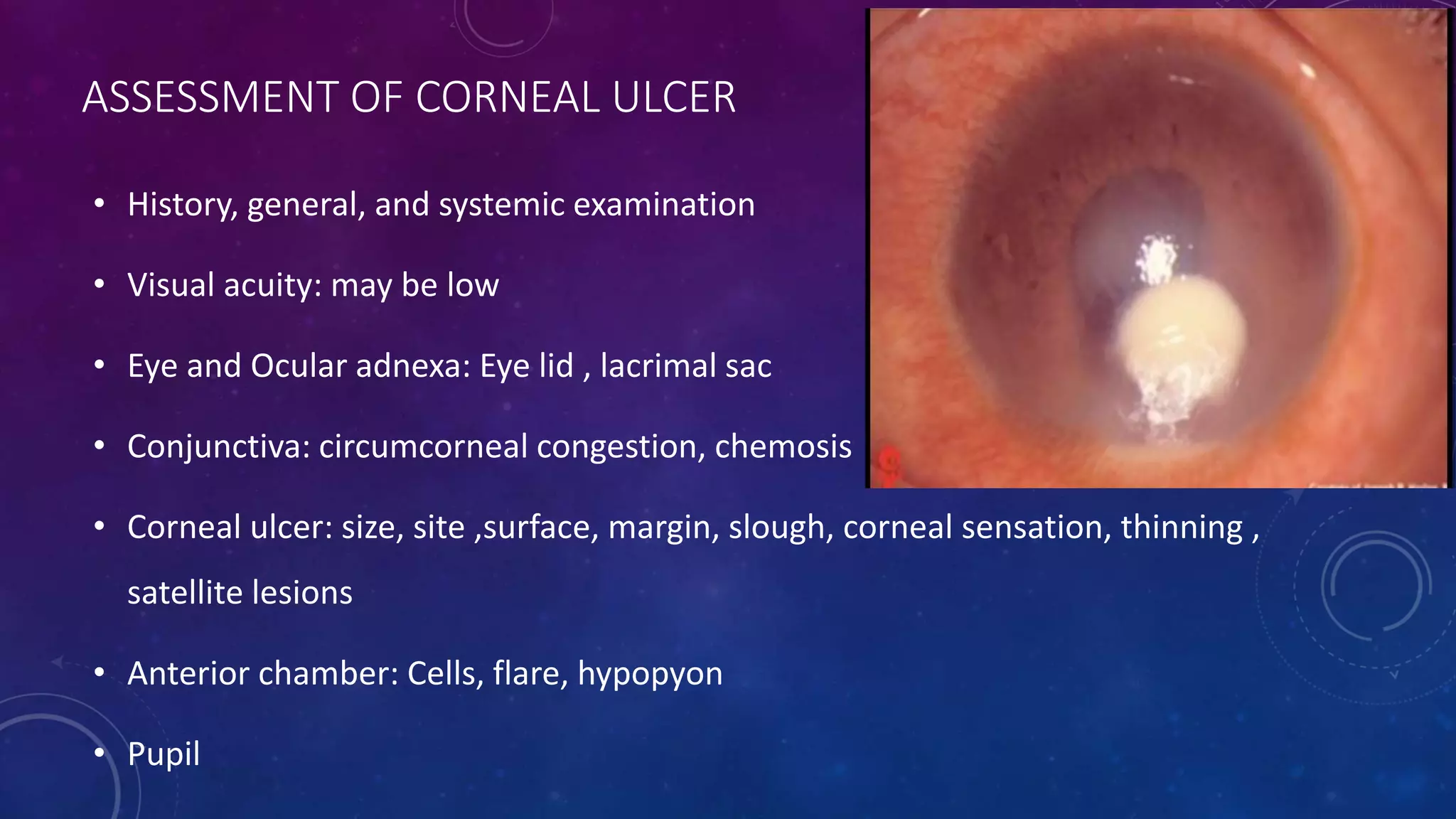 Bacterial corneal ulcers.pptx