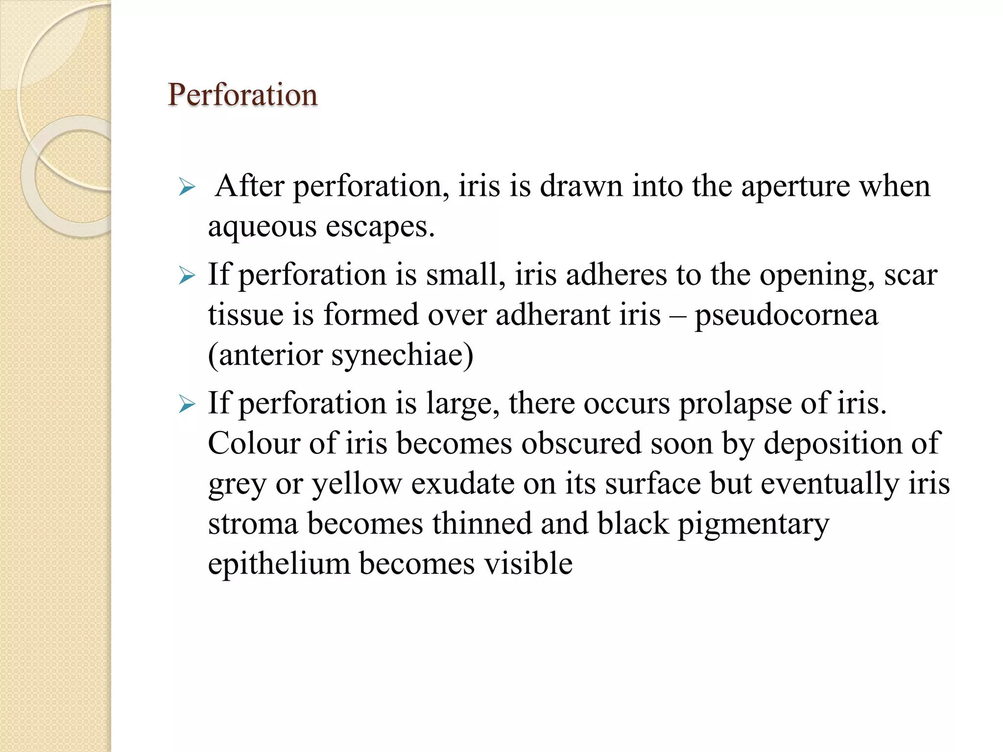Bacterial corneal ulcer | PPTX