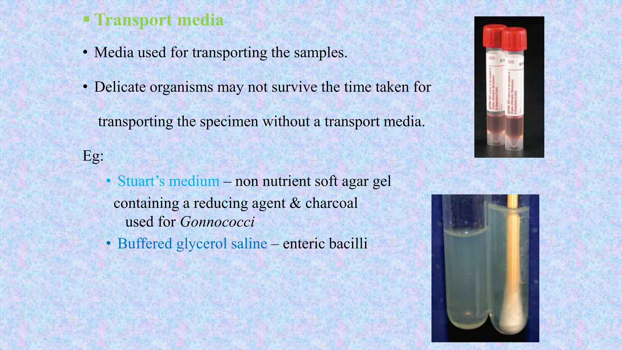 Bacterial culture media by manoj | PPTX