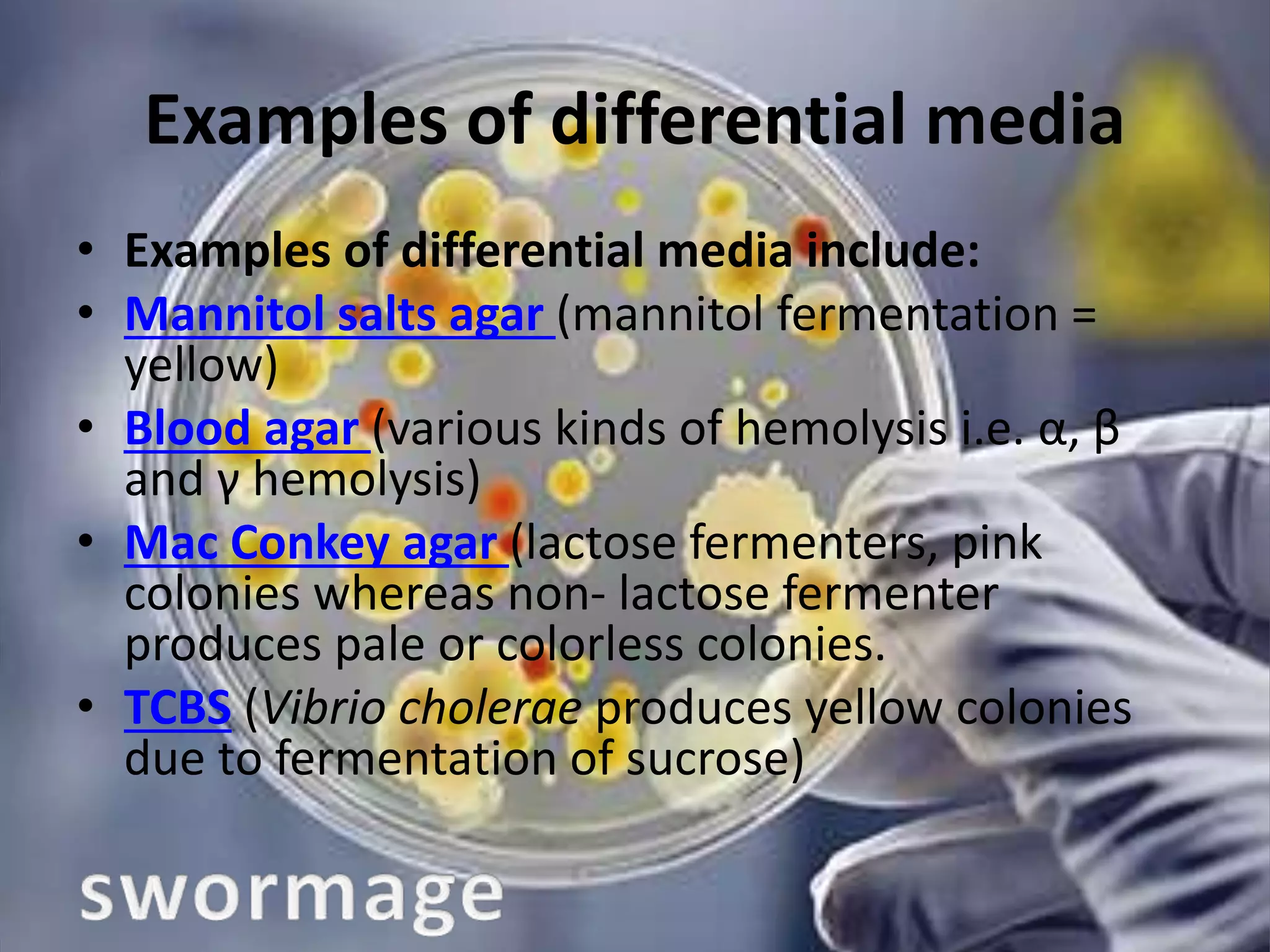 Bacterial culture media by sworna | PPTX