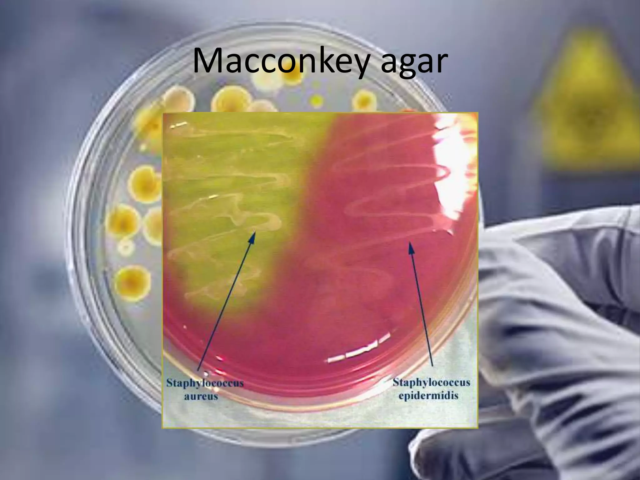 Bacterial culture media by sworna | PPTX