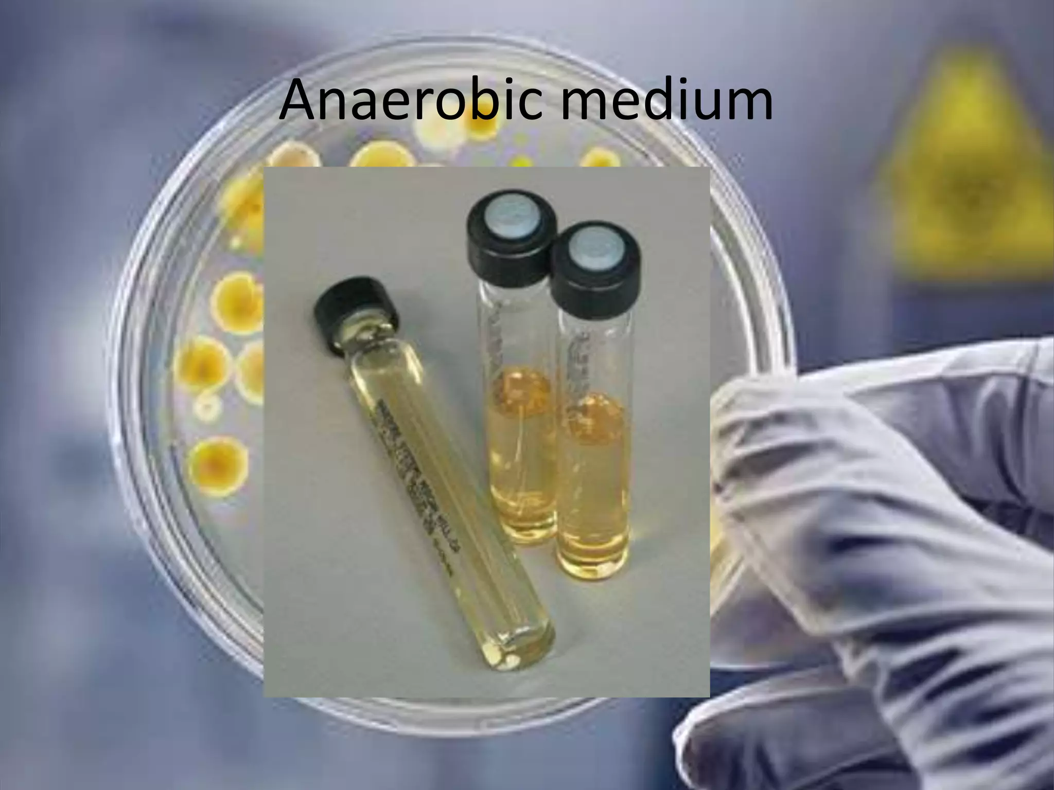 Bacterial culture media by sworna | PPTX