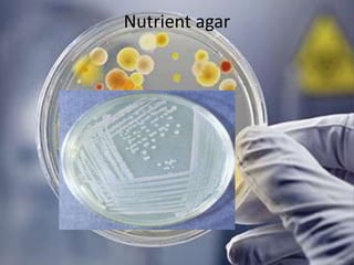 Bacterial culture media by sworna | PPTX