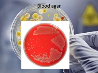 Bacterial culture media by sworna | PPTX