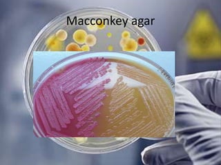 Bacterial culture media by sworna | PPTX