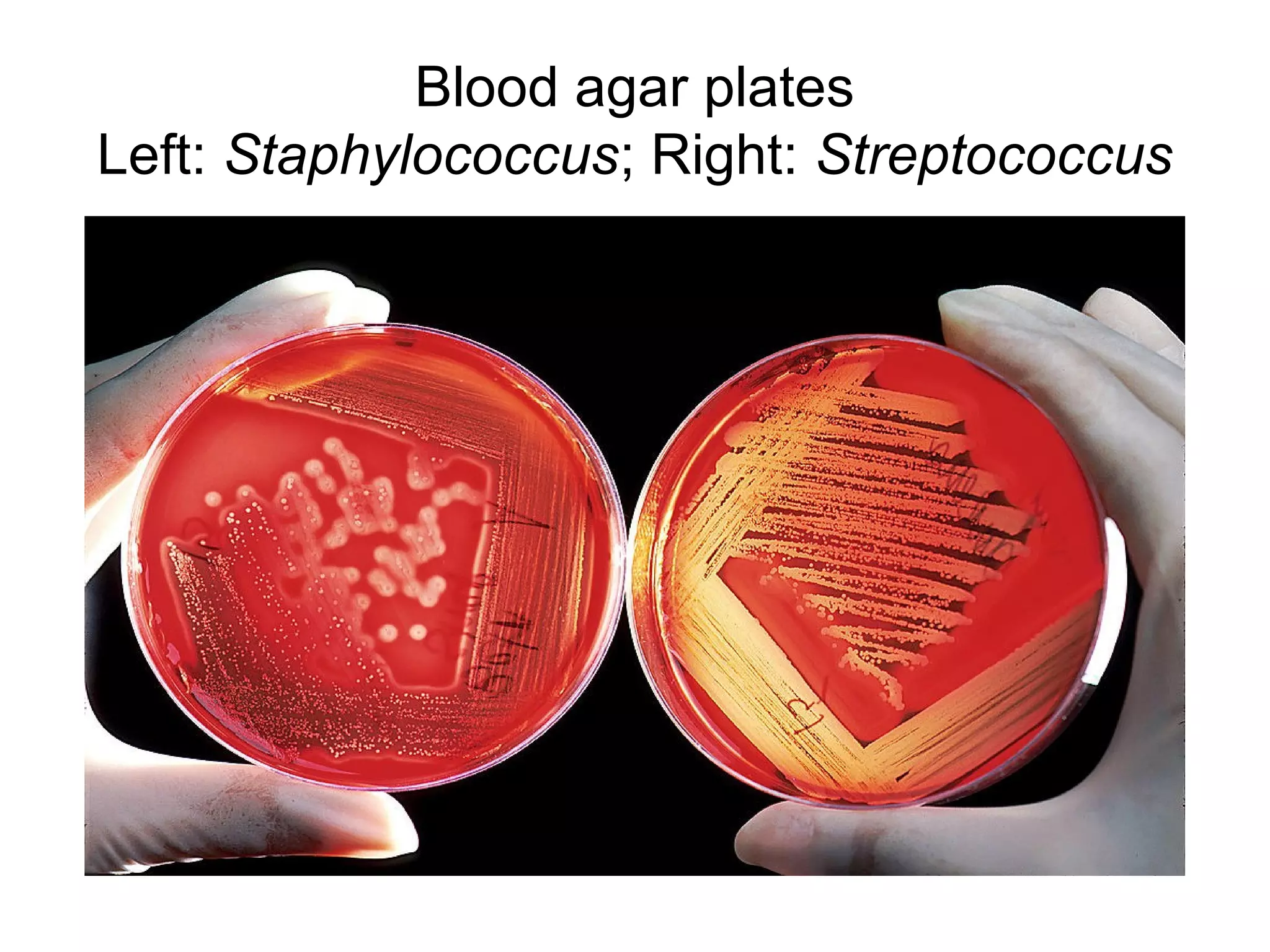 Bacterial cultures morphology based identification | PPT