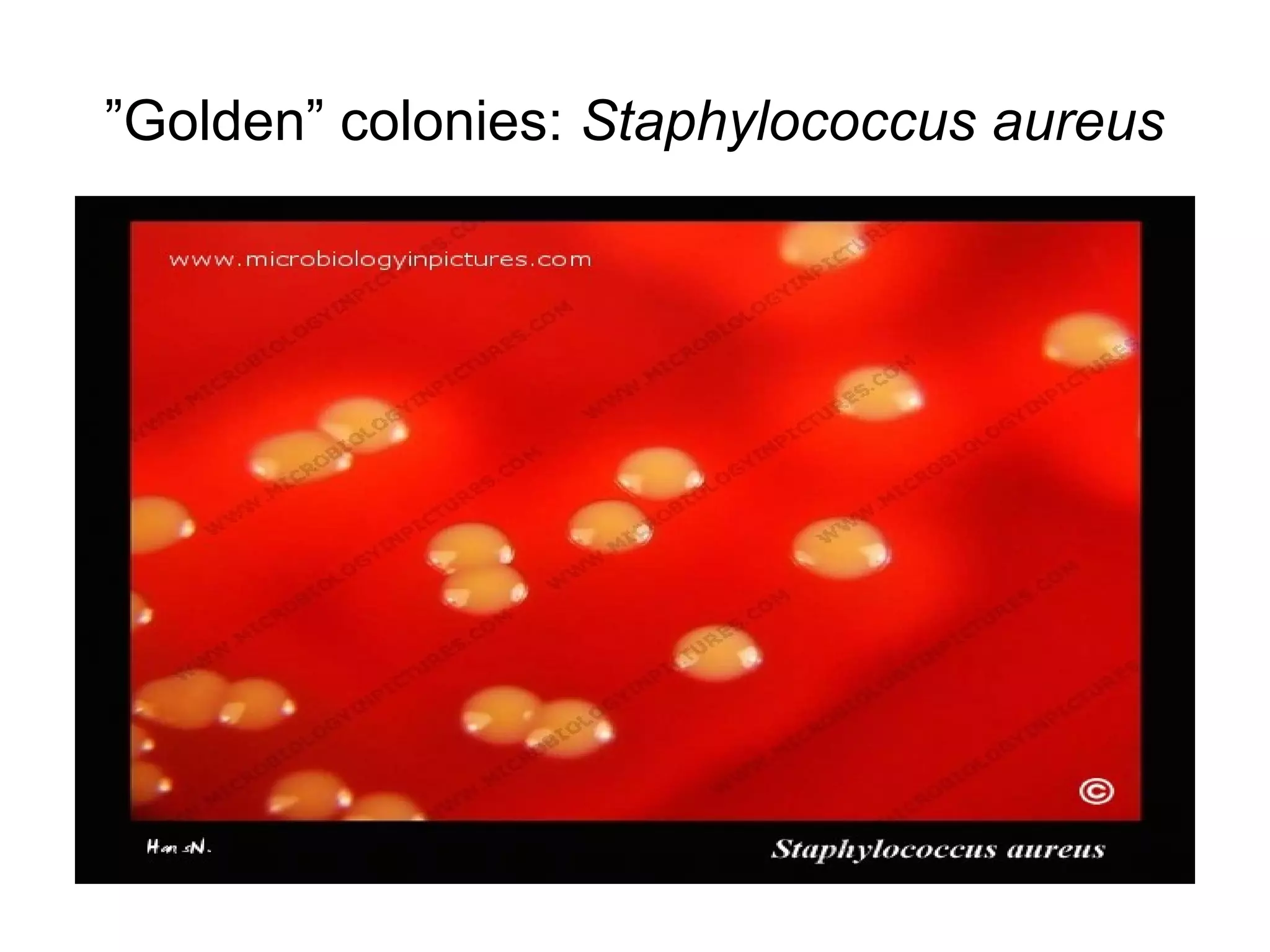 Bacterial cultures morphology based identification | PPT