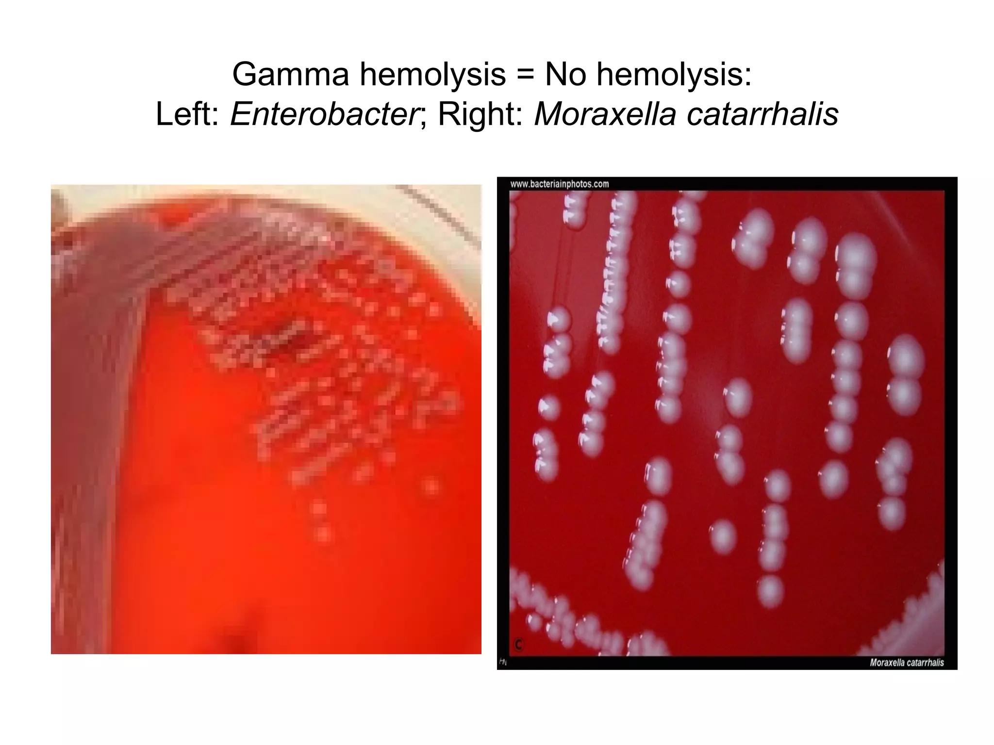 Bacterial cultures morphology based identification | PPT