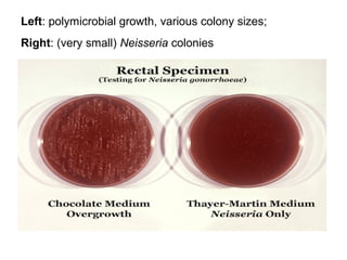 Bacterial cultures morphology based identification | PPT