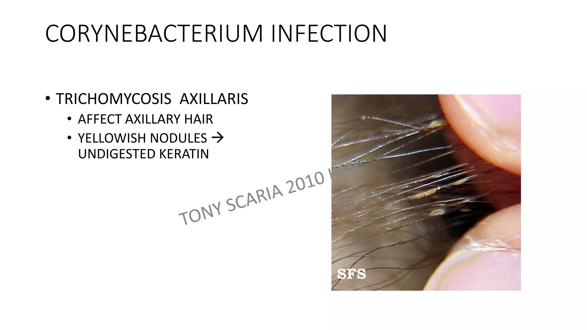 Bacterial cutaneous infection DERMATOLOGY REVISION NOTES | PDF