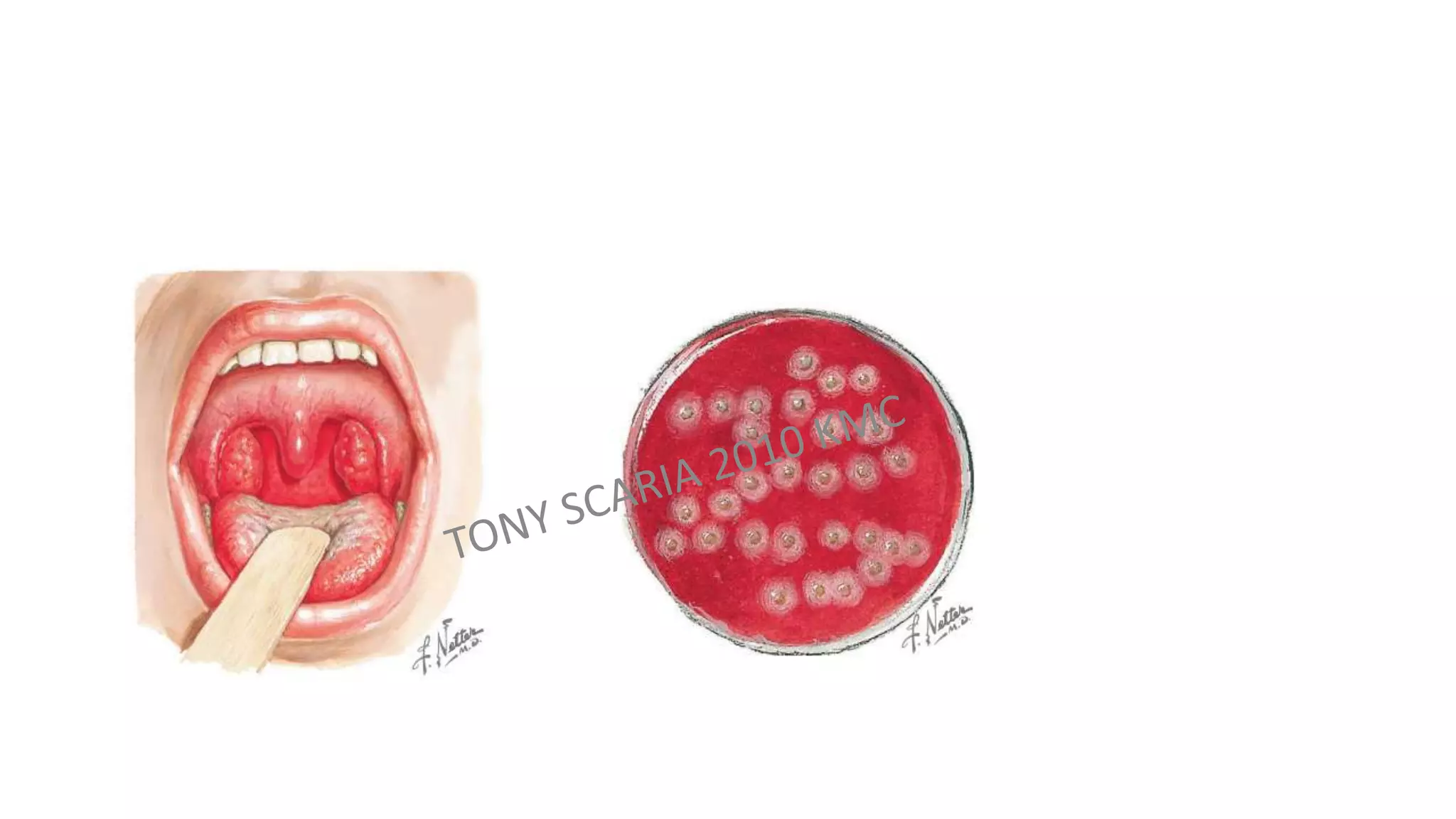 Bacterial cutaneous infection DERMATOLOGY REVISION NOTES | PDF