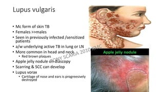 Bacterial cutaneous infection DERMATOLOGY REVISION NOTES | PDF