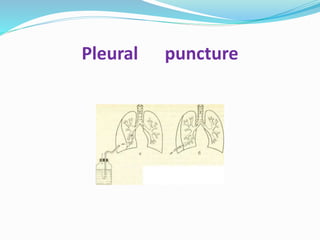 Bacterial destruction of the lungs | PPTX | Lung and Respiratory Health ...