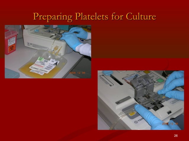 Bacterial Detection Of Platelets Ppt