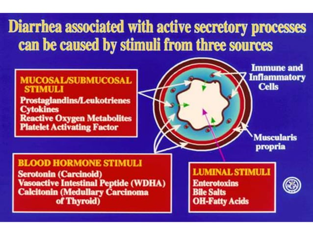 Bacterial diarrhea 2013 4th year unza medical,by DR MWANSA | PPTX ...