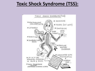 Toxic Shock Syndrome Made Extremely Easy! | PPTX