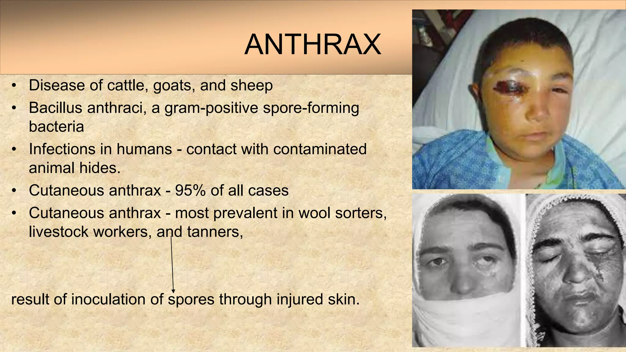 Bacterial eyelid infections and blepharitis. | PPTX