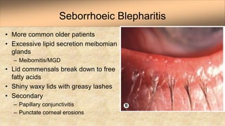 Seborrheic Vs Staph Blepharitis