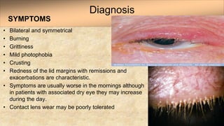 Mild Blepharitis