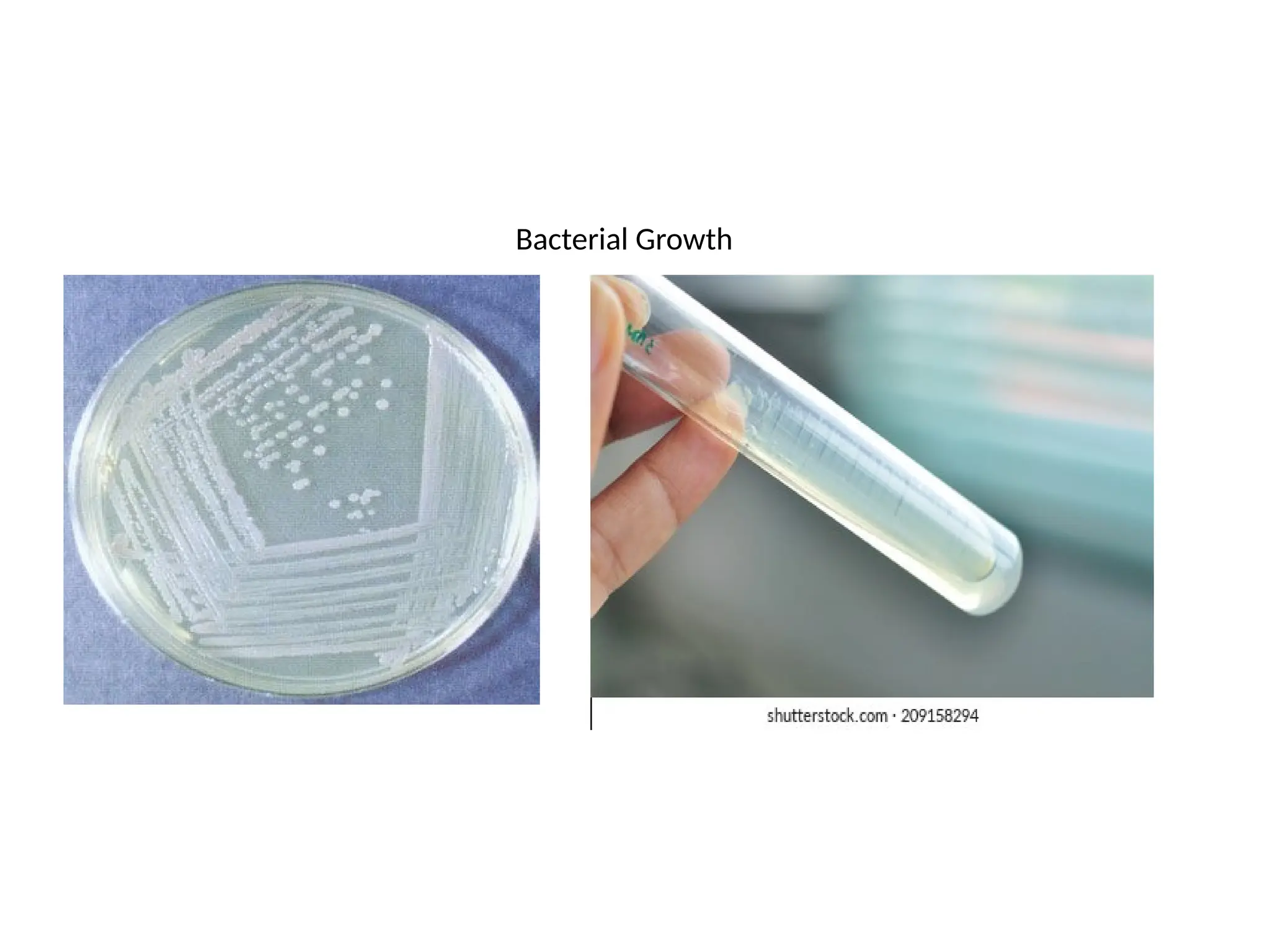 Growth and Growth Pahses of bacterial Growth | PPTX