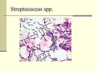 Bacterial Infection (แพทย์) | PPT