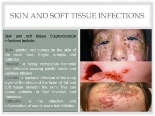 Bacterial infection | PPT | Free Download