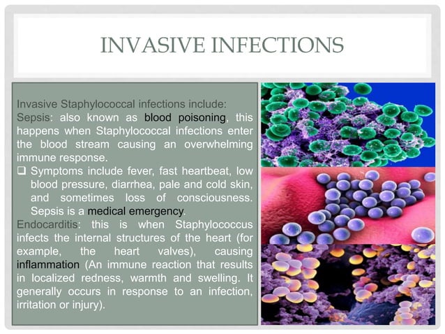 Bacterial infection | PPT | Free Download