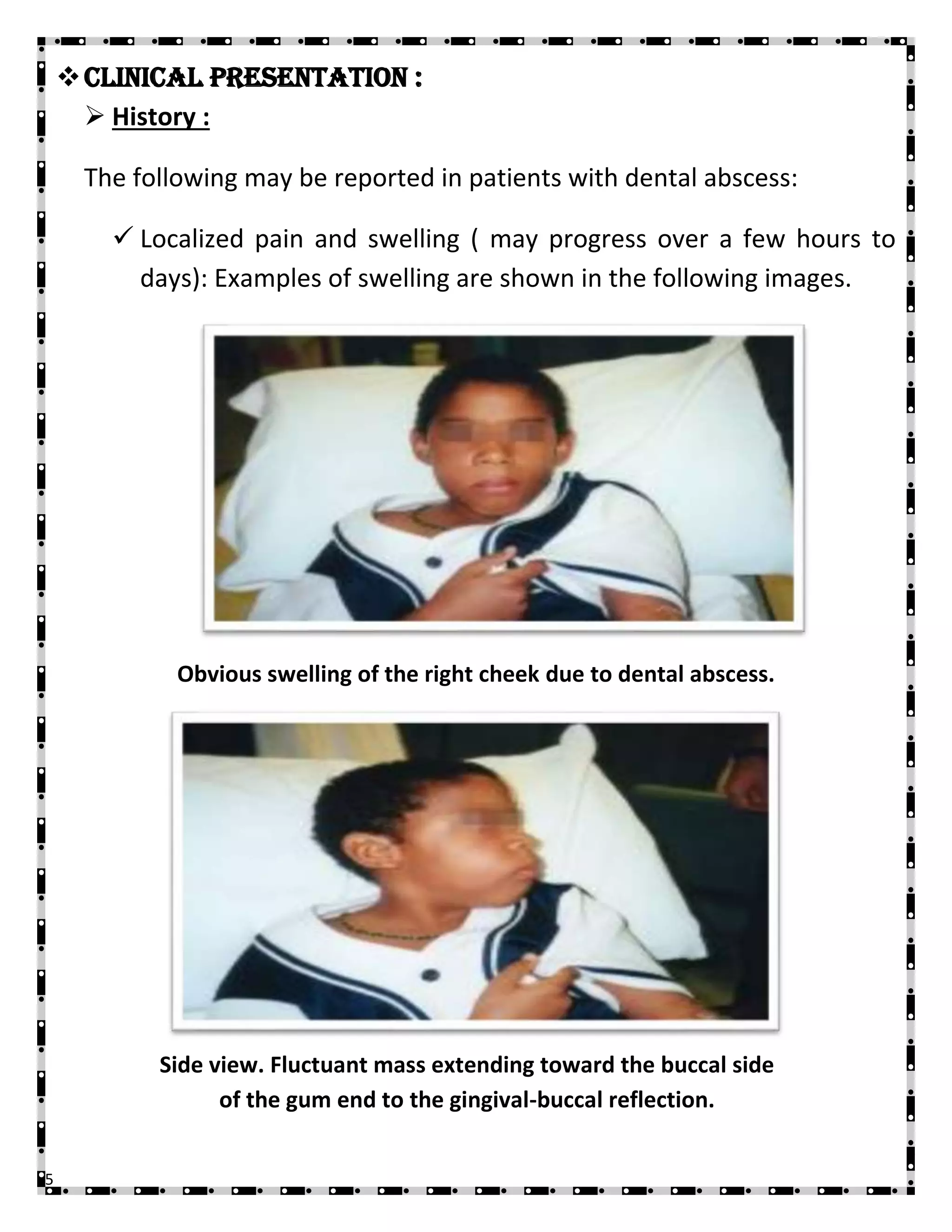 Bacterial infection affecting teeth Dental Abscess | DOCX