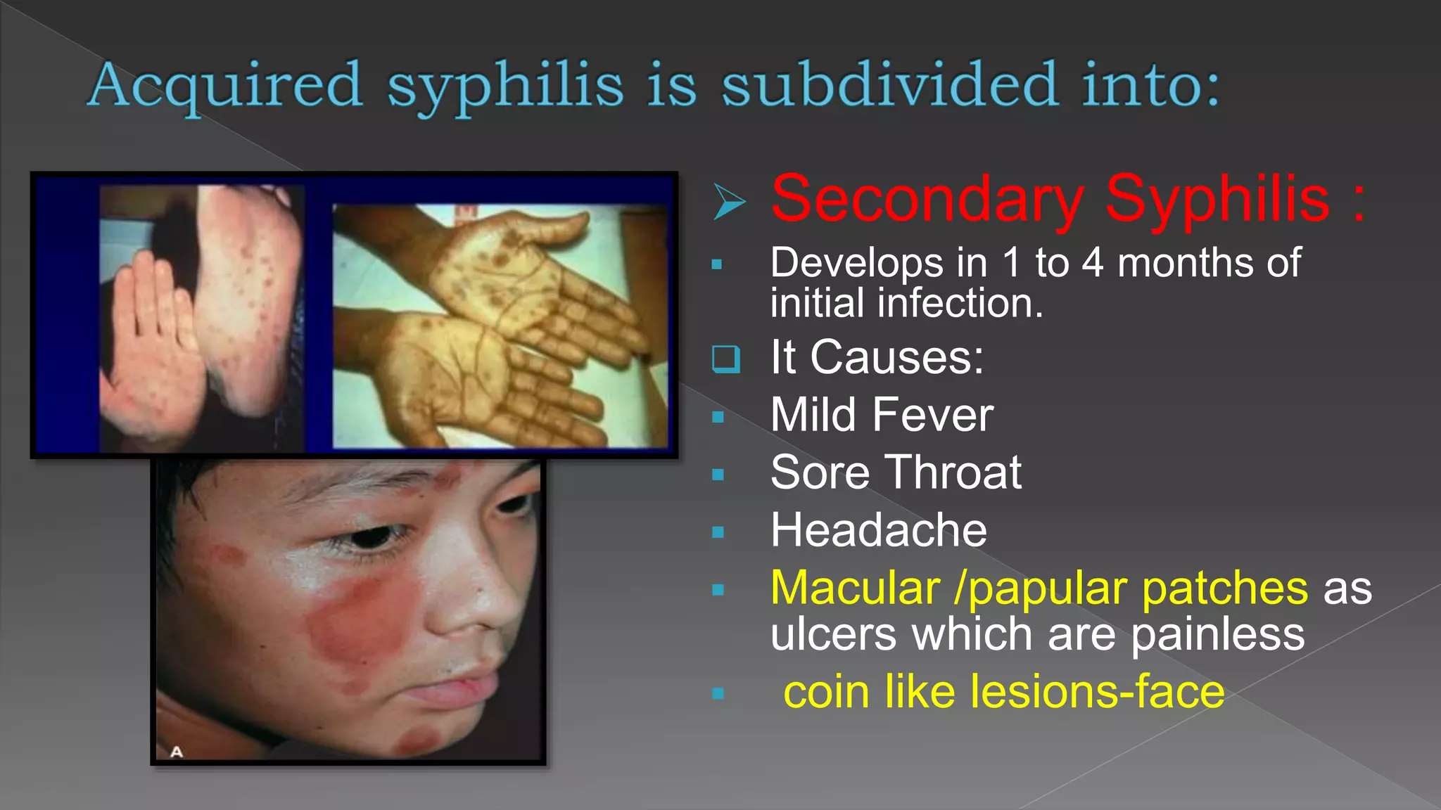 Bacterial infection of the oral cavity (khaled sadeq) | PPTX