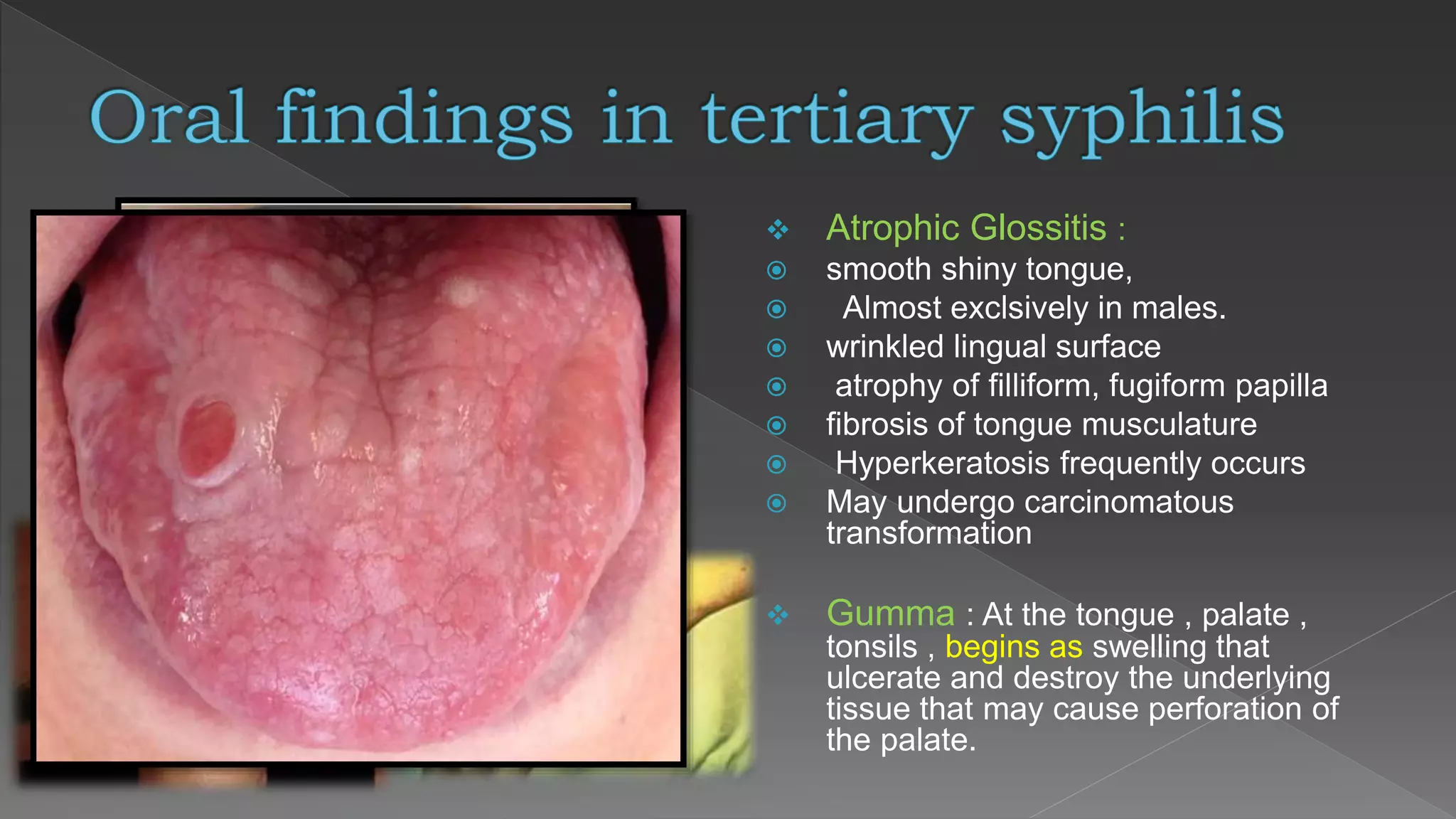 Bacterial infection of the oral cavity (khaled sadeq) | PPTX