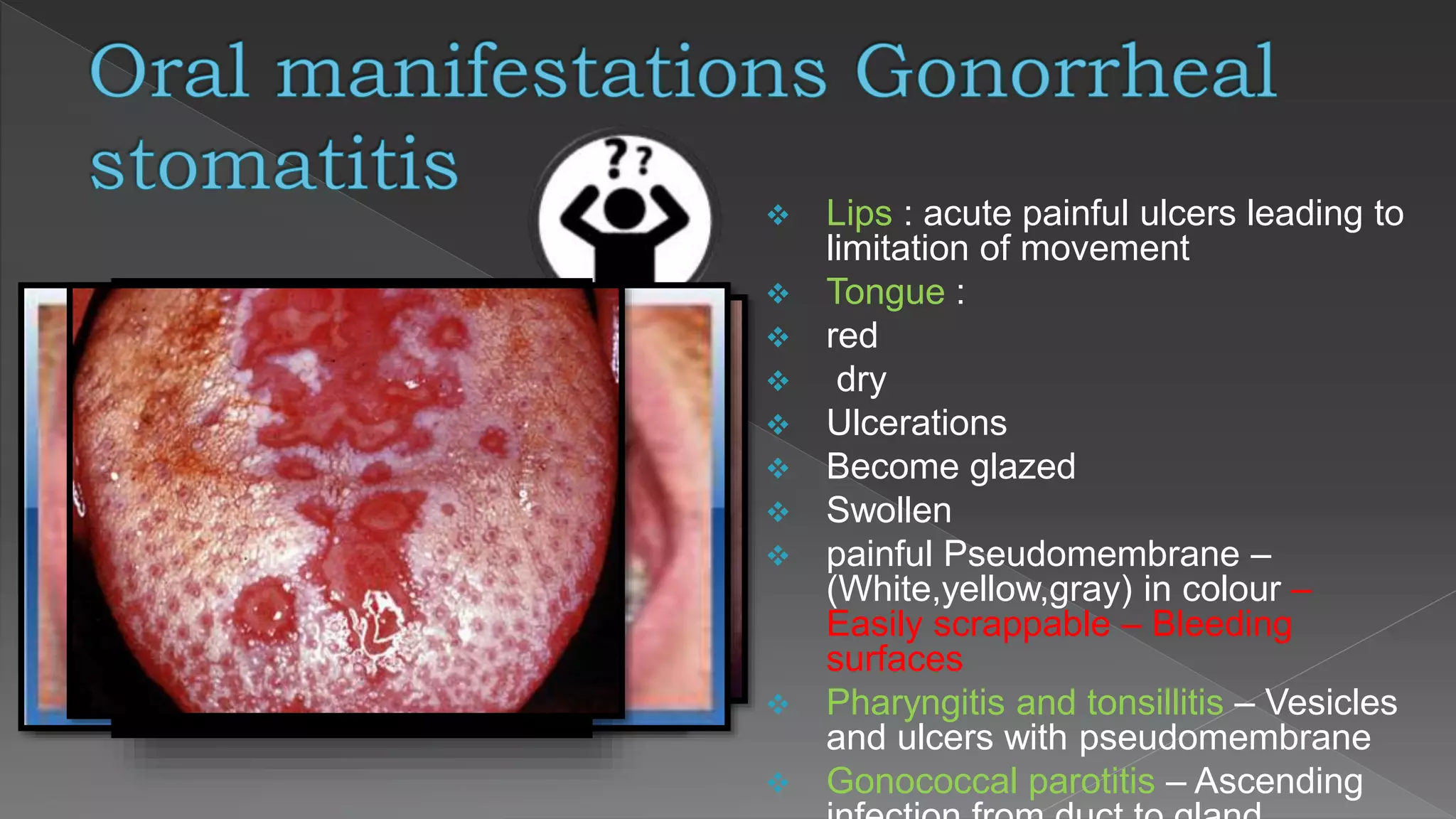Bacterial infection of the oral cavity (khaled sadeq) | PPTX
