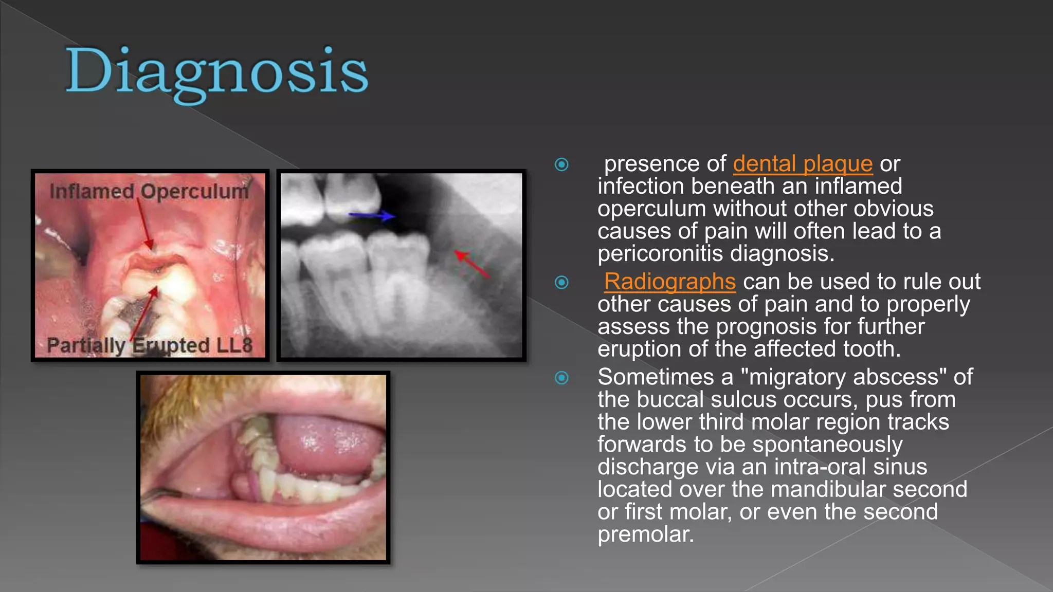 Bacterial infection of the oral cavity (khaled sadeq) | PPTX