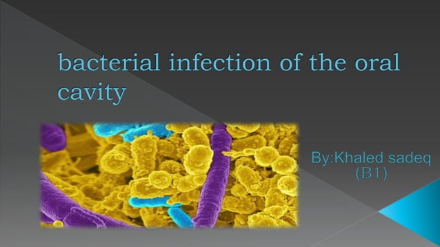 Bacterial infection of the oral cavity (khaled sadeq) | PPT
