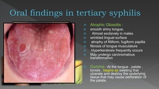Bacterial infection of the oral cavity (khaled sadeq) | PPTX