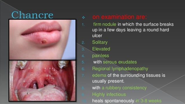 Bacterial infection of the oral cavity (khaled sadeq)