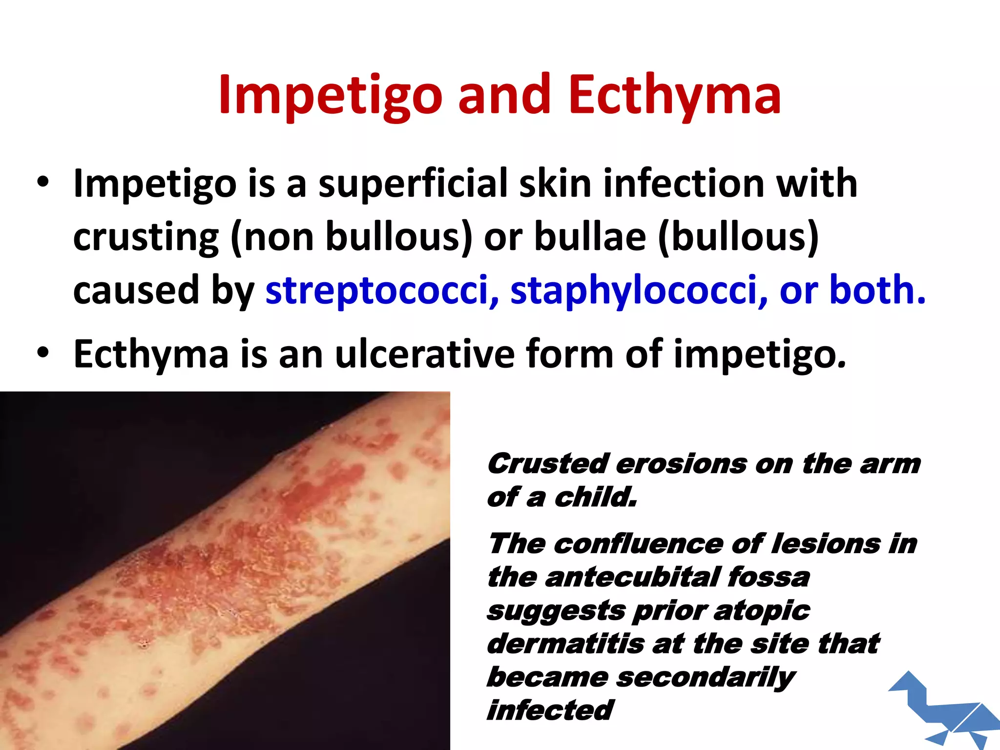 Bacterial infection of the skin | PPTX