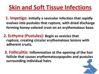 Bacterial infection of the skin | PPTX