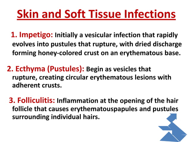 Bacterial infection of the skin | PPTX