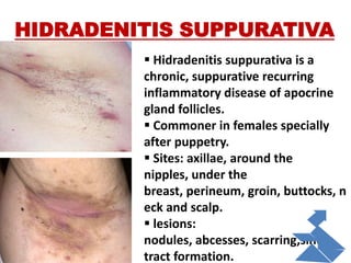 Bacterial infection of the skin | PPTX