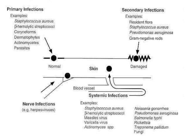Bacterial infection of the skin | PPTX