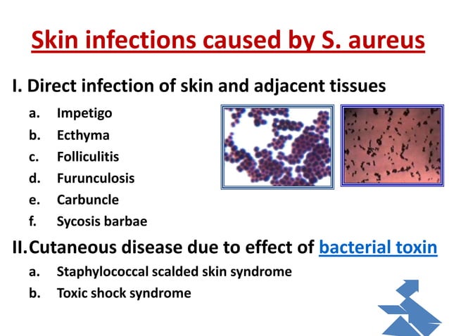 Bacterial infection of the skin | PPTX