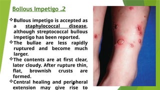 Bacterial infection of the skin.pptx