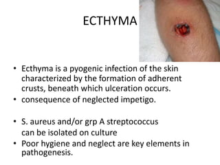 Bacterial infections | PPTX