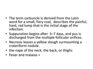Bacterial infections | PPT