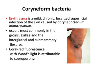 Bacterial infections | PPTX