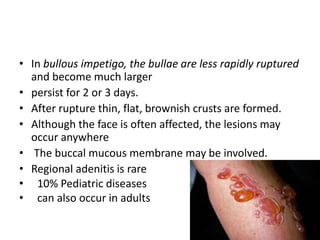 Bacterial infections | PPT