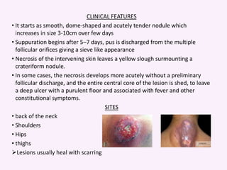 Bacterial Infections of the Skin: Clinical, Diagnostic, and Therapeutic ...
