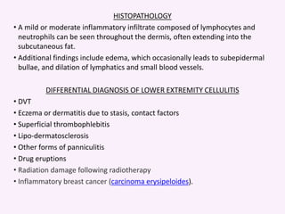 Bacterial Infections of the Skin: Clinical, Diagnostic, and Therapeutic ...