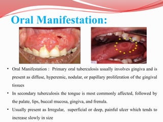bacterial infections affecting the Oral cavity.pptx