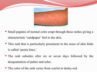 bacterial infections affecting the oral cavity.pptx